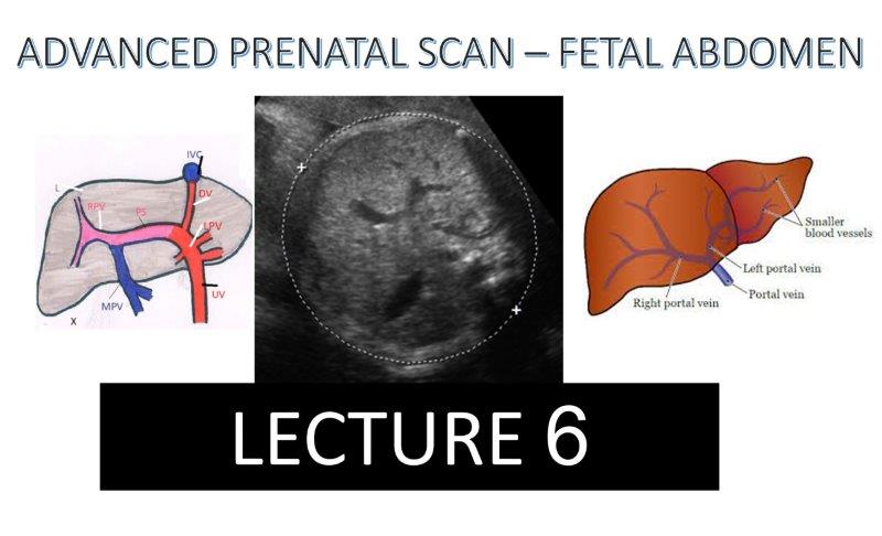 Home of OBGYN Lectures | Table1