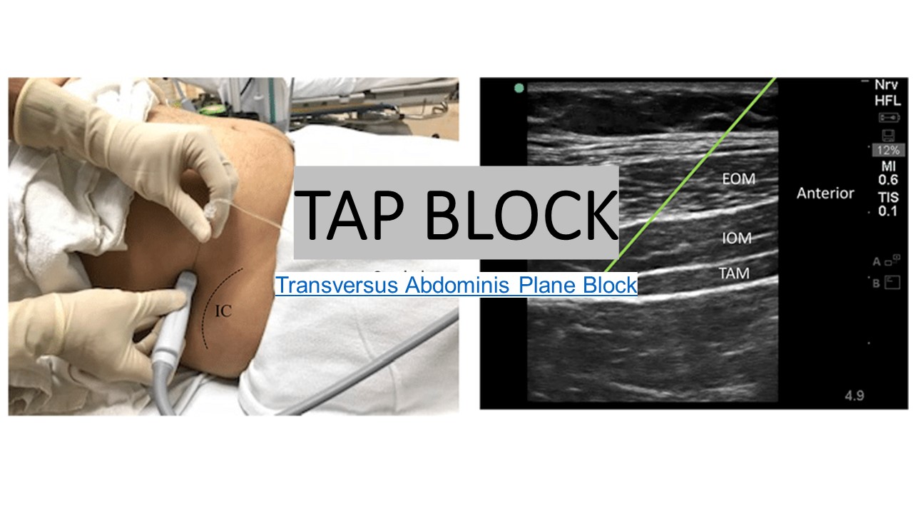 Home of OBGYN Lectures | Table1