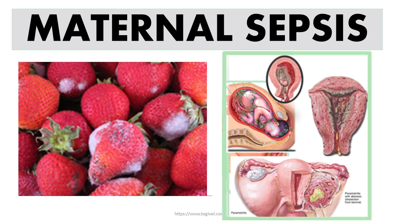 Home of OBGYN Lectures | Table1